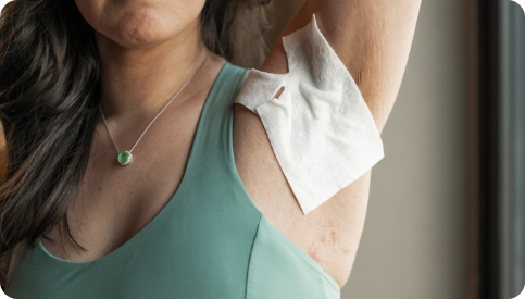 Hidradenitis Suppurativa: What it is, Causes, and Symptoms